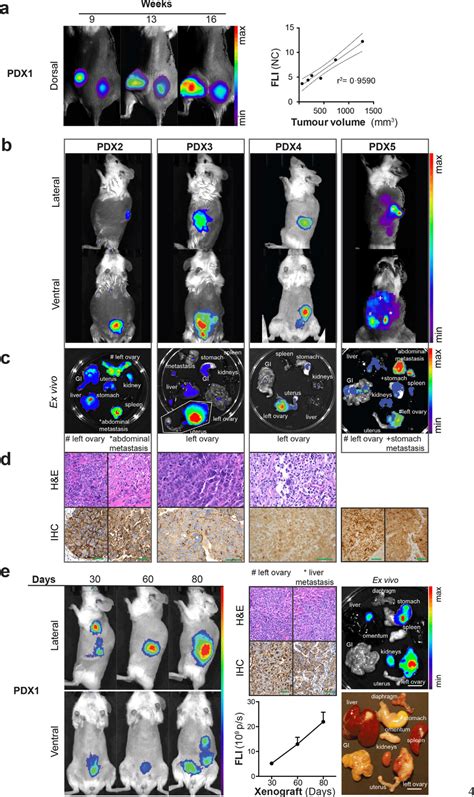 Fluorescence Imaging Of High Grade Serous Ovarian Cancer Download