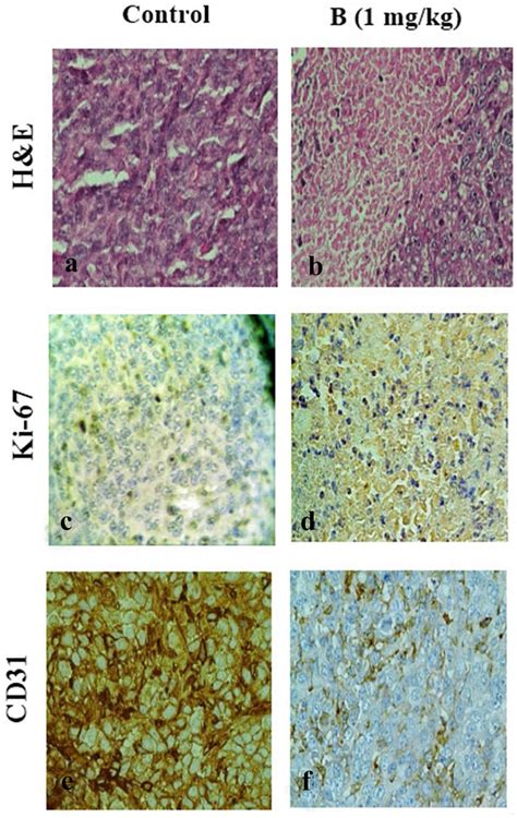 A Novel Hydrazide Compound Exerts Anti Metastatic Effect Against Breast