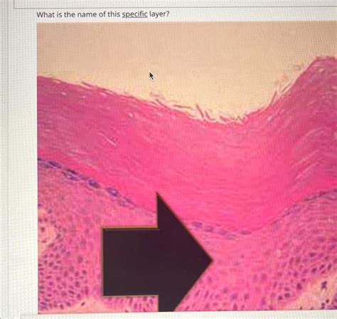 Solved What Is The Name Of This Specific Layer