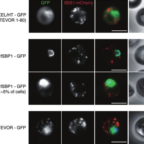 P Falciparum Maurers Cleft Proteins Colocalize With Ibis1 When