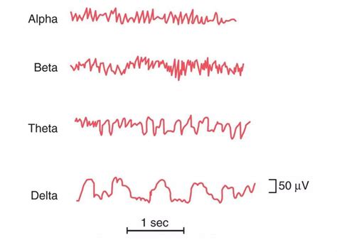 Evoked Potentials Clinical Importance And Physiological Basis Of