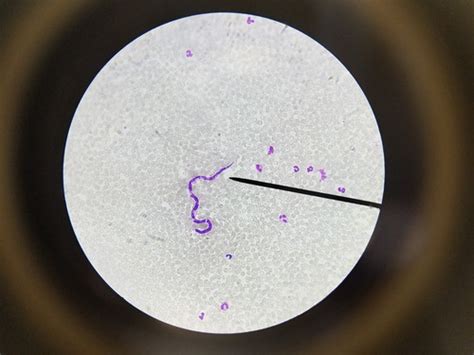 Parasitology Lab Practical 3 Flashcards Quizlet