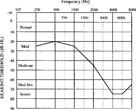 Figure 1 From An Architecture For Wavelet Packet Based Speech Enhancement For Hearing Aids