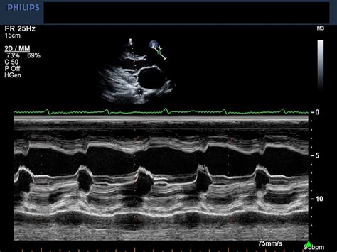 Analyze This Image M Mode Malady