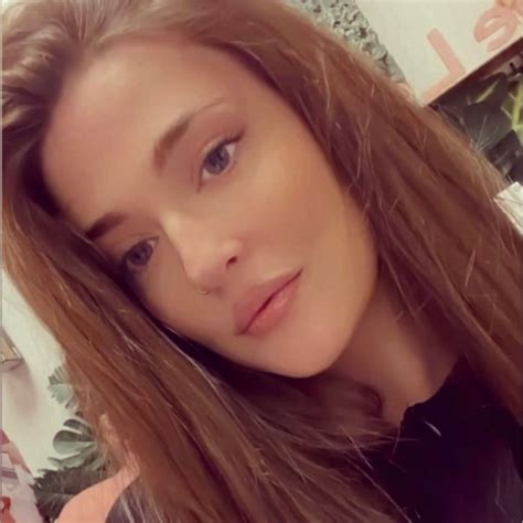 Molly Lowe Nhs Coordinator Spire Healthcare Group Plc Linkedin