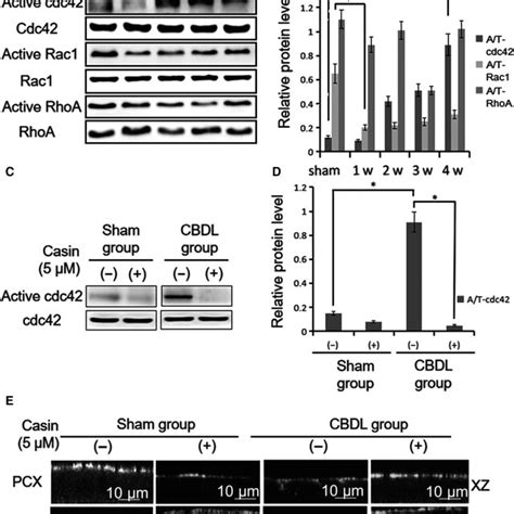 Cbdl Rat Serum Induces Cell Polarity Defects Via Cdc42 A The Pull