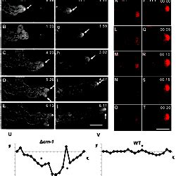 Comparative Morphogenesis And Spk Behavior Revealed By Staining Hyphae With FM