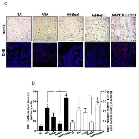 Ijms Special Issue Inflammation And Tumor Progression Signaling