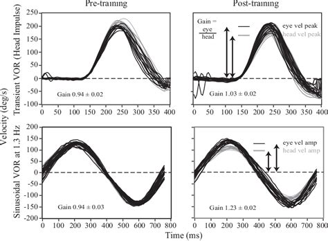 Figure From Human Vestibulo Ocular Reflex Adaptation Is Frequency Selective Semantic Scholar