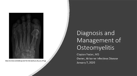 Diagnosis And Management Of Osteomyelitis Commons Wikimedia