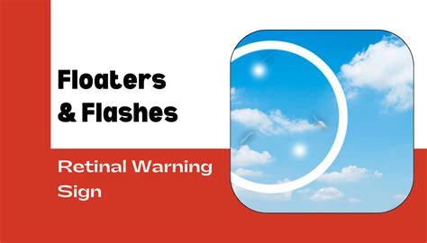 Floaters And Flashes Is It A Retinal Warning Sign Laxmi Eye Hospital
