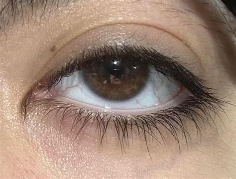 Do I Have Distichiasis Double Lashes Rmakeupaddiction