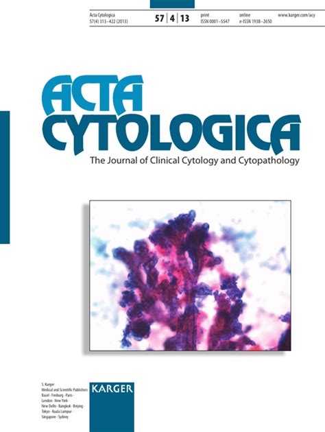 Differential Diagnosis Of Reactive Mesothelial Cells And Malignant Mesothelioma Cells Using The