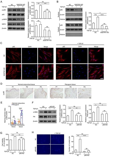 Tgf β1 Promoted Fibrosis Of Primary Confb Through Activating