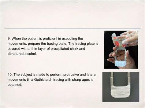 Gothic Arch Tracing Pptx