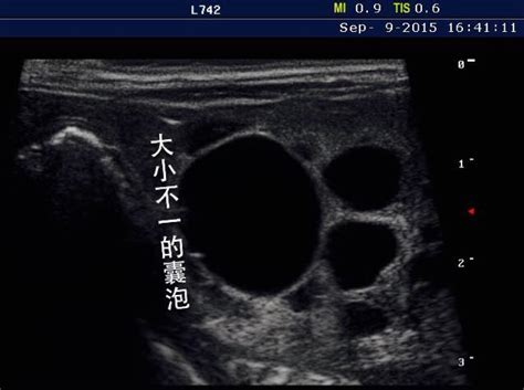 貓咪的多囊性腎臟病 PKD 周春婷貓專科獸醫師