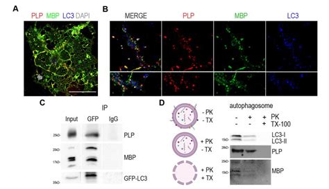 Autophagic Degradation Of Cns Myelin Maintains Axon Integrity