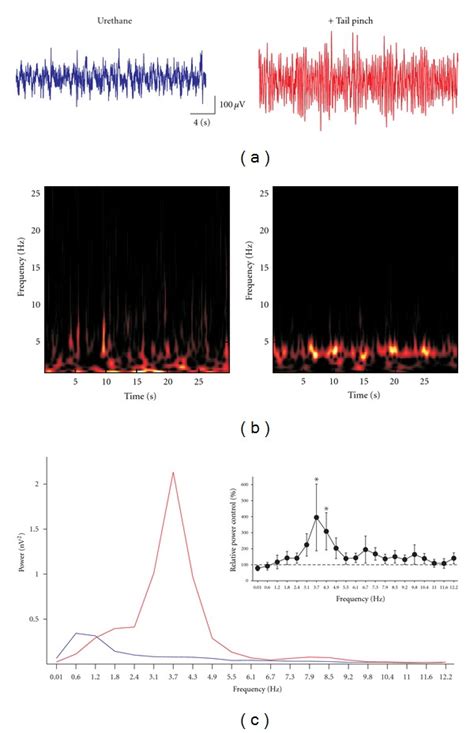 Sensory Stimulation Induces Hippocampal Theta Oscillations A Download Scientific Diagram