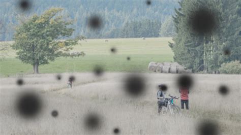 Diabetic Retinopathy Dr Ahmed Sheikh Elarab