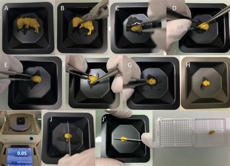 Quantitative Neuroanatomical Phenotyping Of The Embryonic Mouse Brain