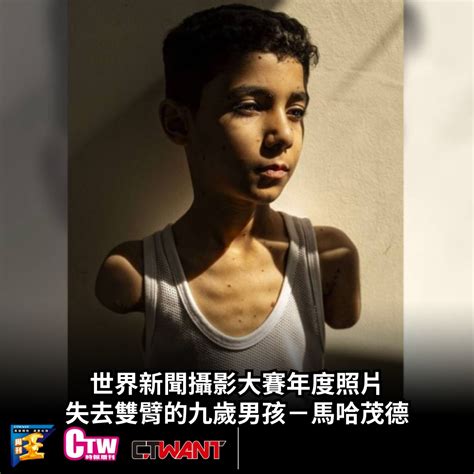 馬哈茂德的夢想很簡單：他想裝上義肢，像其他孩子一樣自由自在地生活溪