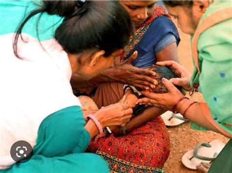 बीते 5 साल में उदयपुर जिले में खसरा रुबेला वेक्सीनेशन की स्थिति