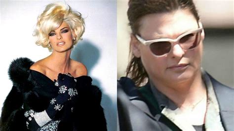 Linda Evangelista Sufre Fuerte Depresión Tras Quedar ‘desfigurada Por
