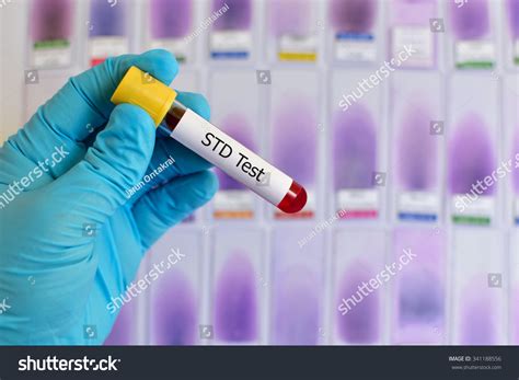 Blood Sample Sexually Transmitted Diseases Std Stock Photo Shutterstock