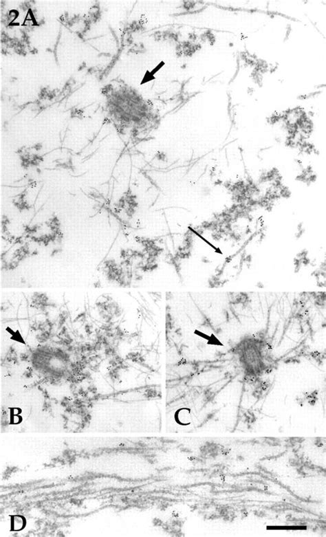 Immunoelectron Microscopic Analyses On Katanin Distribution In Rat