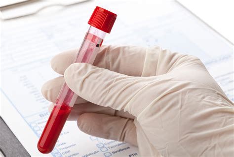 PrÉÉclampsie Le Nouveau Biomarqueur Qui La Prédit Santé Log
