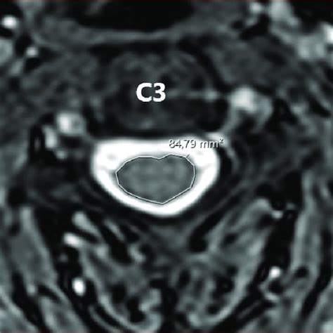 The Mean Values According To C3 And C6 Levels Download Scientific Diagram