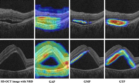 Visualisation Of The Results From Different Pooling Operations Namely Download Scientific