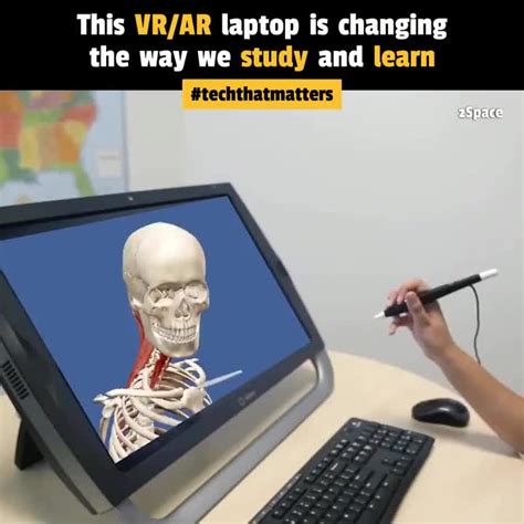 Vinitha Gokulakrishnan Posted On Linkedin