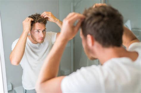 Oily Scalp Causes Treatment And Prevention Noophoric