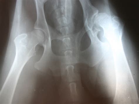 Tobillo Inflamado Después De Dos Meses De Un Esguince Huesos Y