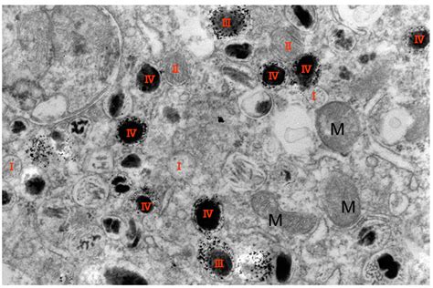 Transmission Electron Microscope Observation Electron Microscopic Download Scientific Diagram