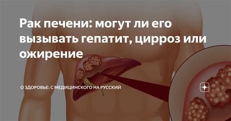 Рак печени могут ли его вызывать гепатит цирроз или ожирение О здоровье с медицинского на