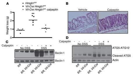 Jci Cytosolic Hmgb1 Controls The Cellular Autophagy Apoptosis Checkpoint During Inflammation