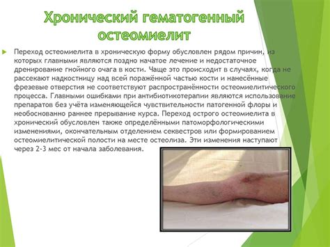 Остеомиелит Этиология и патогенез презентация онлайн