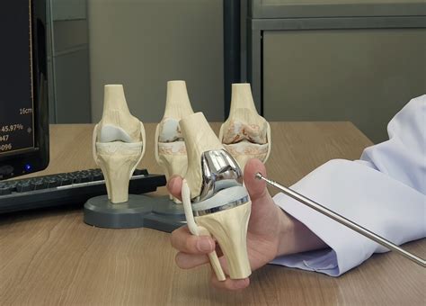 Complete Details About The Types Of Knee Replacement Surgery