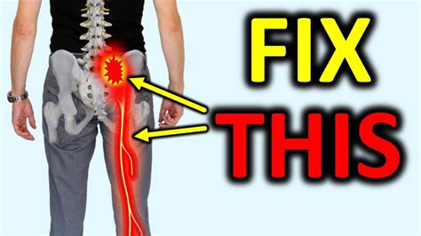 Instant Sciatica Pain Relief With 2 Easy Exercises YouTube