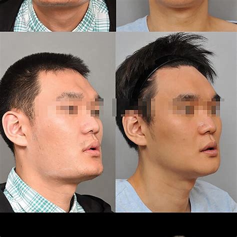 Clinical Photographs And Computed Tomography Scans In A Patient Who