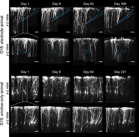 Transected Dendrites In The Electrode Path Atrophy Over Time 2 D Mips