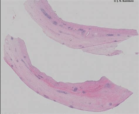 Gallbladder And Exocrine Pancreas Flashcards Quizlet