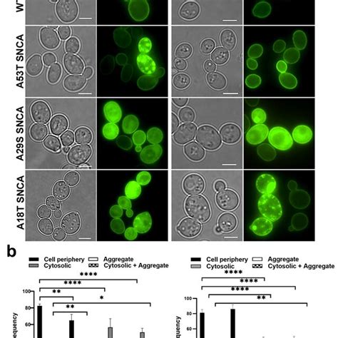 Expression And Localization Of α Synuclein Double Mutant Variants In S