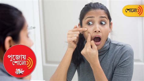 Simple Ways To Get Rid Of Pimples Fast