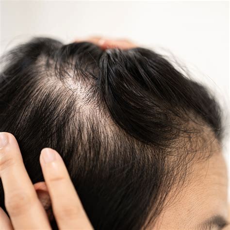 8 Quick Easy Hairstyles For Older Women Who Want To Cover Bald Spots