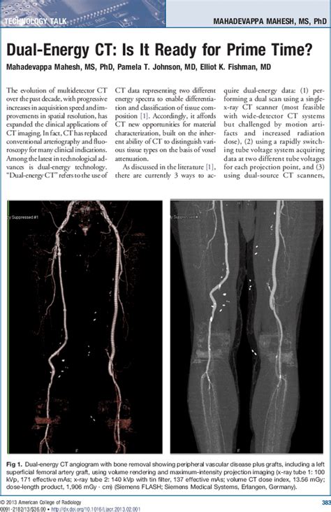 Dual Energy Ct Is It Ready For Prime Time Journal Of The American College Of Radiology