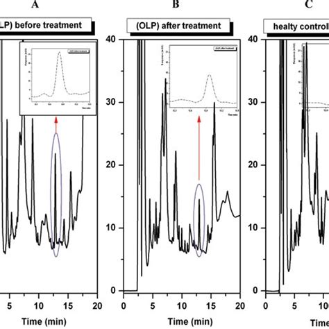 Reversed Phase Hplc Chromatograms Of Whole Saliva Samples Obtained From Download Scientific