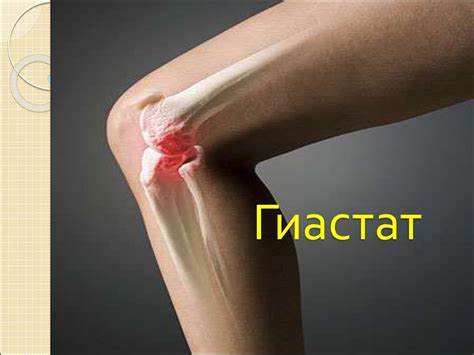 Гиастат - online presentation